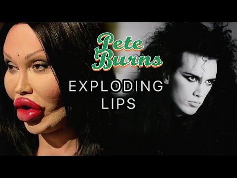 Pete Burns lips LITERALLY exploded! His insane life! - YouTube