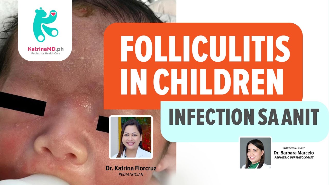 Folliculitis in Children (Skin Infection sa Anit) - YouTube