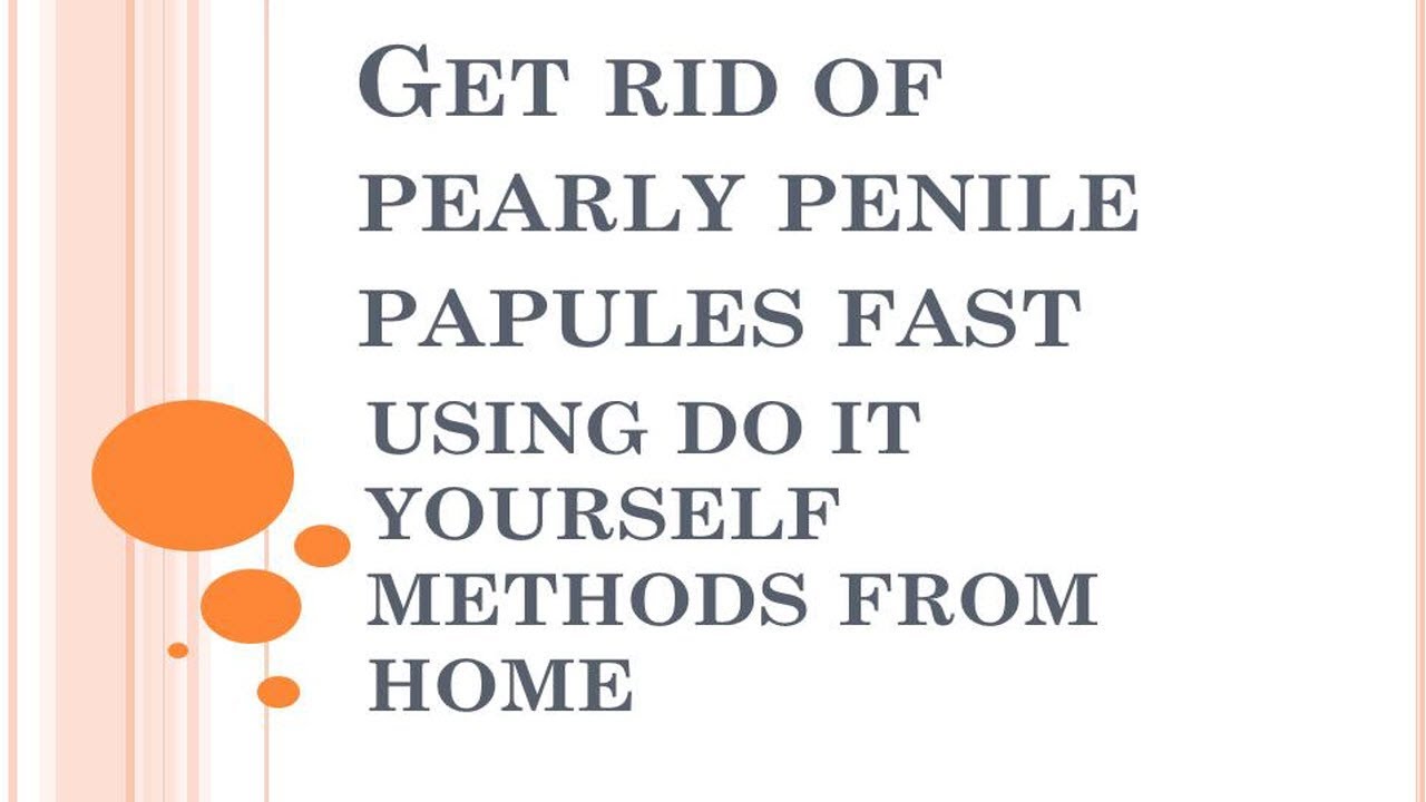 (Penile Papules) How To Remove Pearly Penile Papules Fast And ...