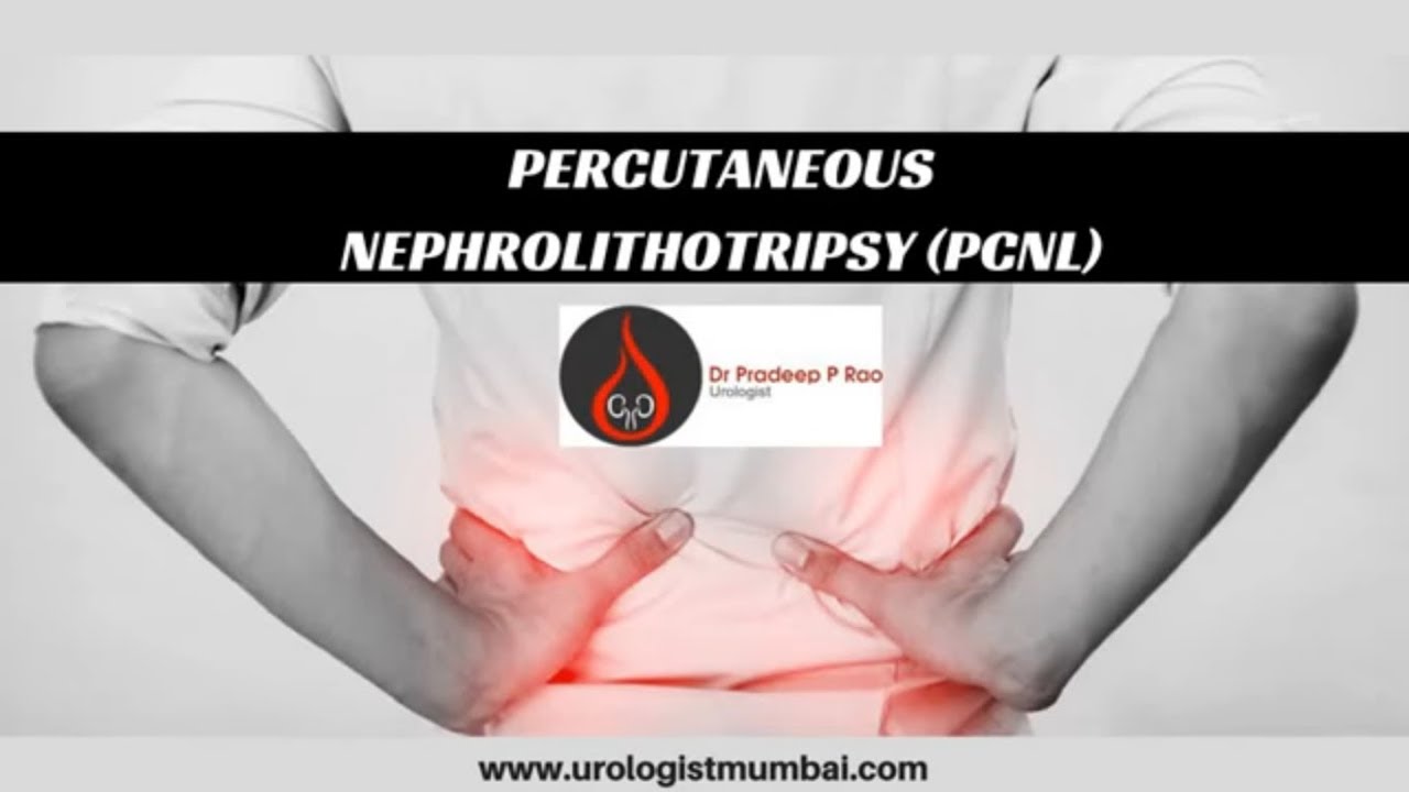 PCNL Surgery in Mumbai | Keyhole Surgery for Kidney Stone | Kidney ...