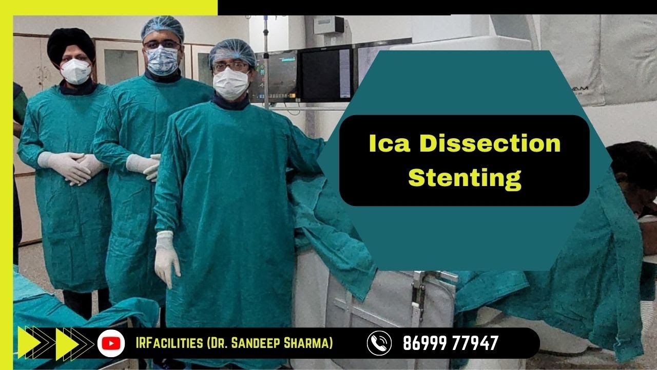 ICA Dissection Stenting #irfacilities #doctor #health #livesurgery # ...