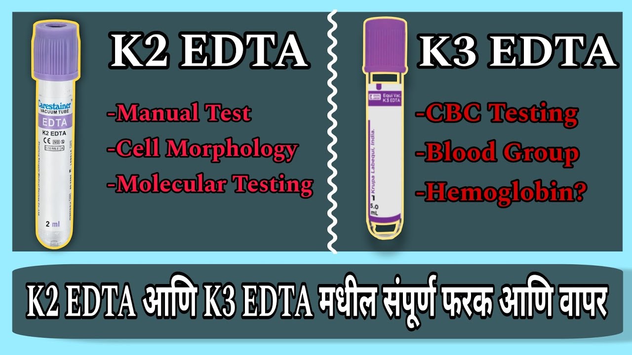 K2 vs K3 EDTA test tube pathology lab uses uses full information in ...