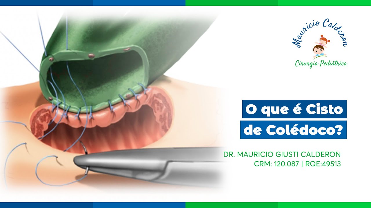 Cirurgia Infantil Channel | O que é Cisto de Colédoco? - YouTube