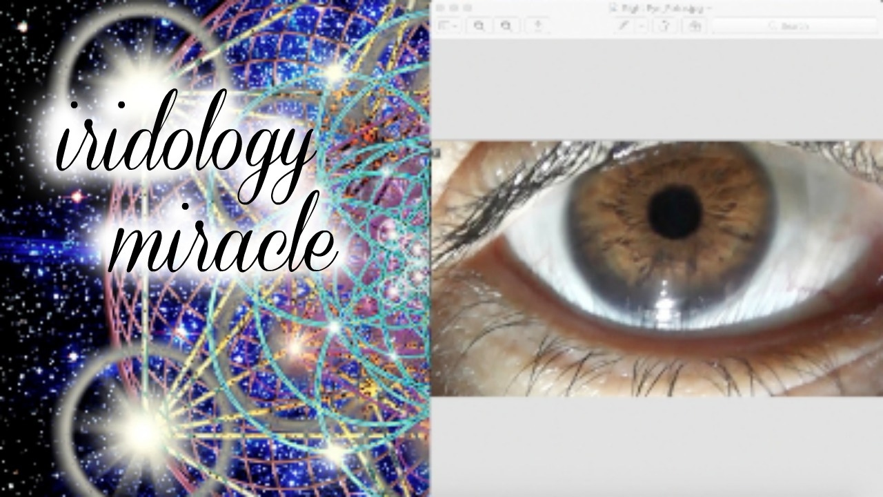 How I Lightened My Eyes Naturally | Dr. Morse Detox RESULTS! - YouTube