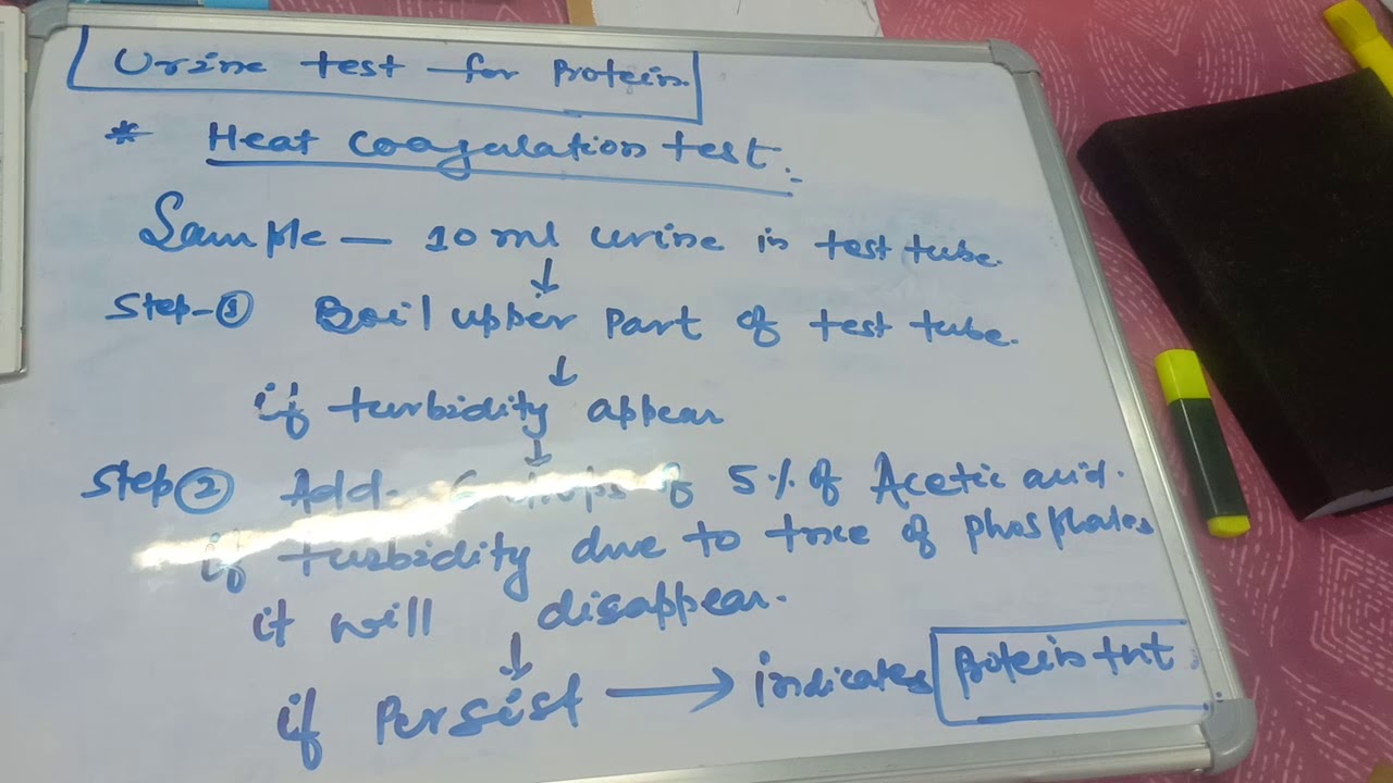 Urine test for protein..heat coagulation test(1) - YouTube