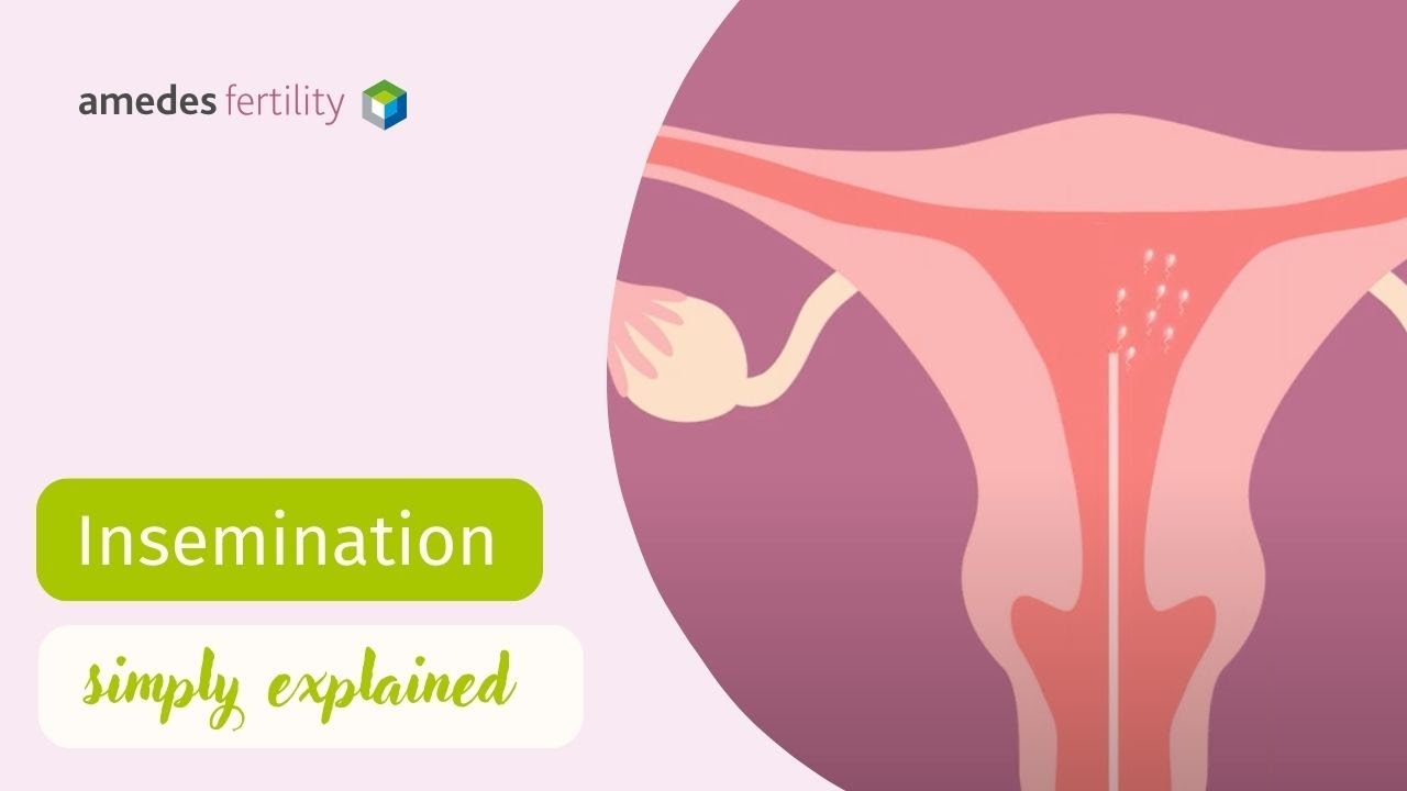 Insemination: Everything you need to know about! - YouTube