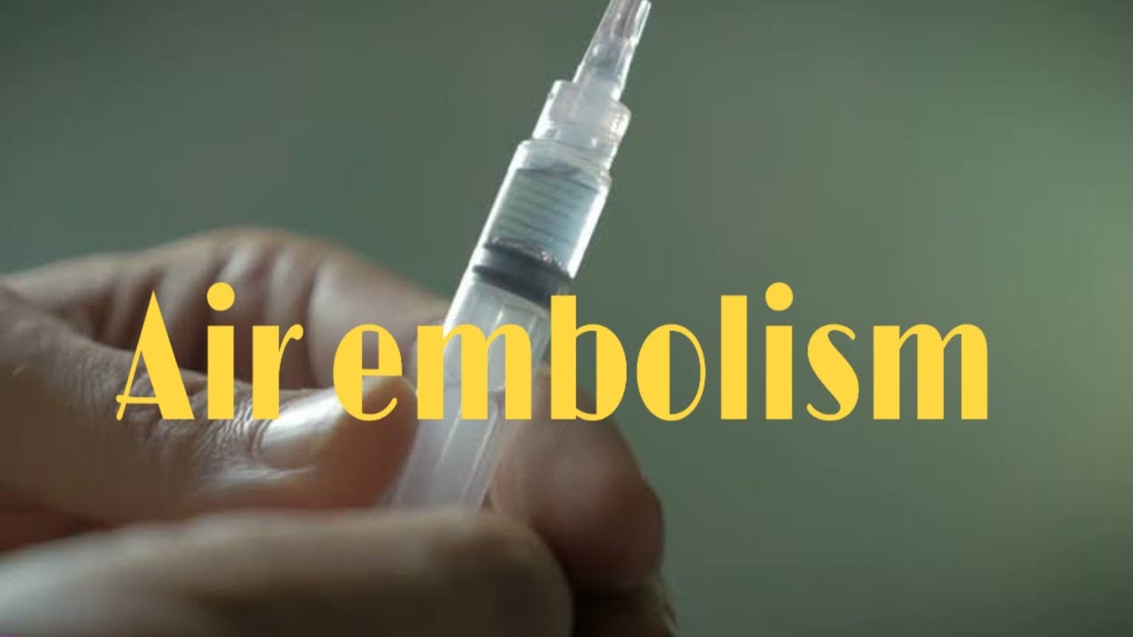 #Embolism Air embolism explain in odia.. - YouTube