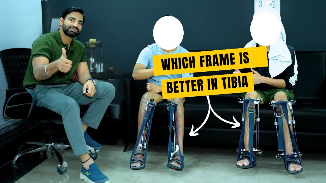 Which frame is better in tibia lengthening? - YouTube