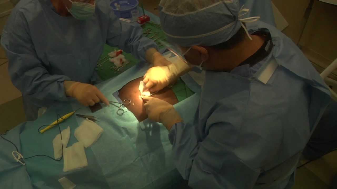 PD Catheter Procedure - Ammar Almehmi, MD, MPH - UT Medical Group ...