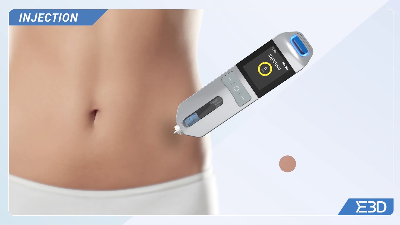 Flexi-Q eMU-C Dual Chamber Cartridge - YouTube