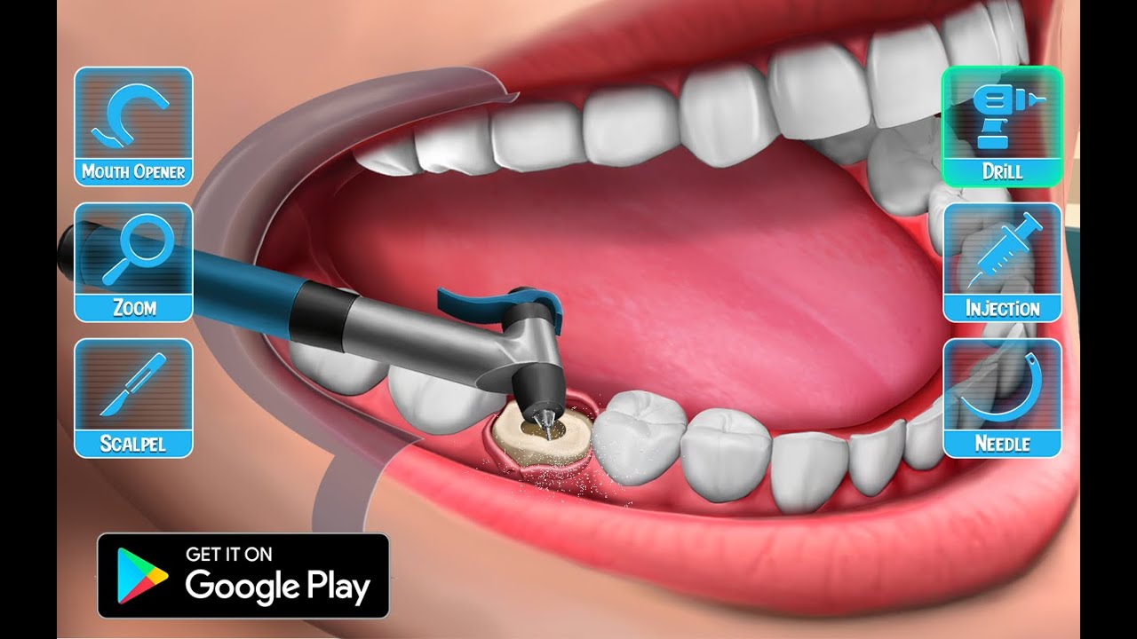 The Caring Souls | Dental Gameplay Trailer | Dental Surgery | Surgery ...