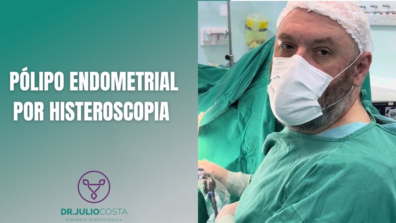 Eliminar Pólipo Endometrial De Forma Natural - RETOEDU