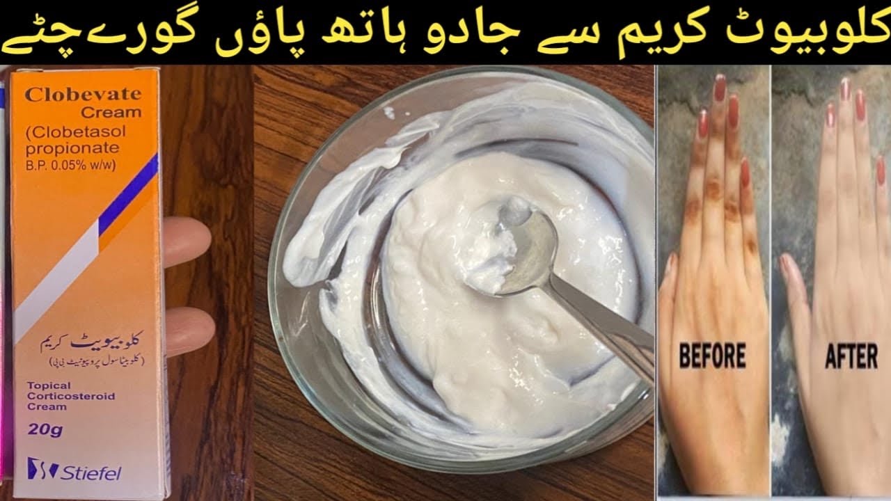 Clobevate cream for hands & feet whitening ||clobevate formula with ...