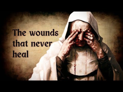 The Bizarre Phenomenon of Stigmata In The Catholic Church