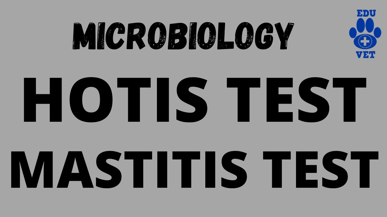 Hotis Test - YouTube