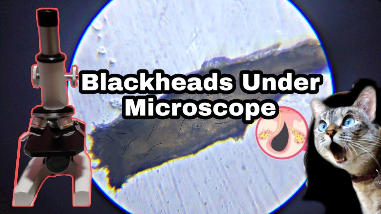 Nose Blàckhêad Under Microscope / Blàckhêads Hidung di Microscope Ini ...