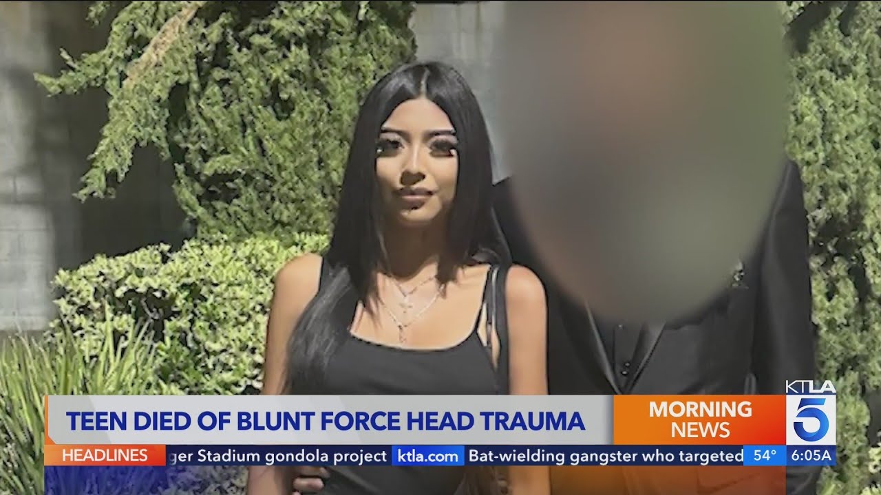 Los Angeles student died of ‘accidental’ blunt head trauma: examiner ...