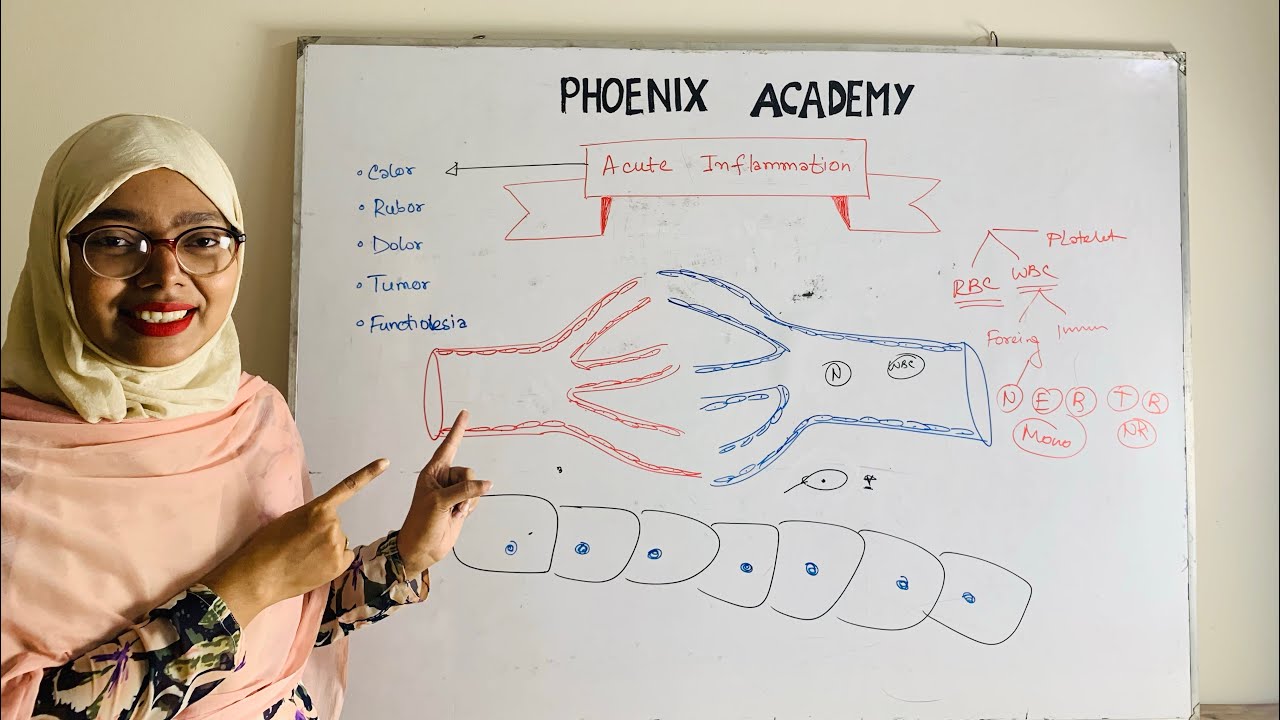Acute inflammation (Calor, Rubor, Dolor, Tumor & Loss of function in ...
