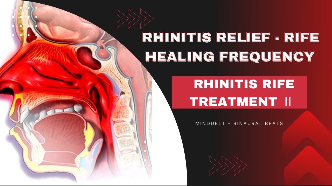 Rhinitis Relief - Rife Healing Frequency | Isochronic Binaural Beats ...