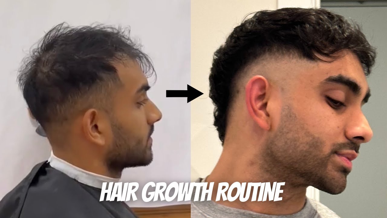 How I Grew My Hair Back - YouTube