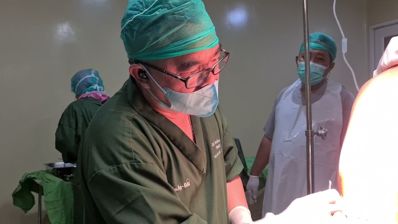 miles procedure - YouTube