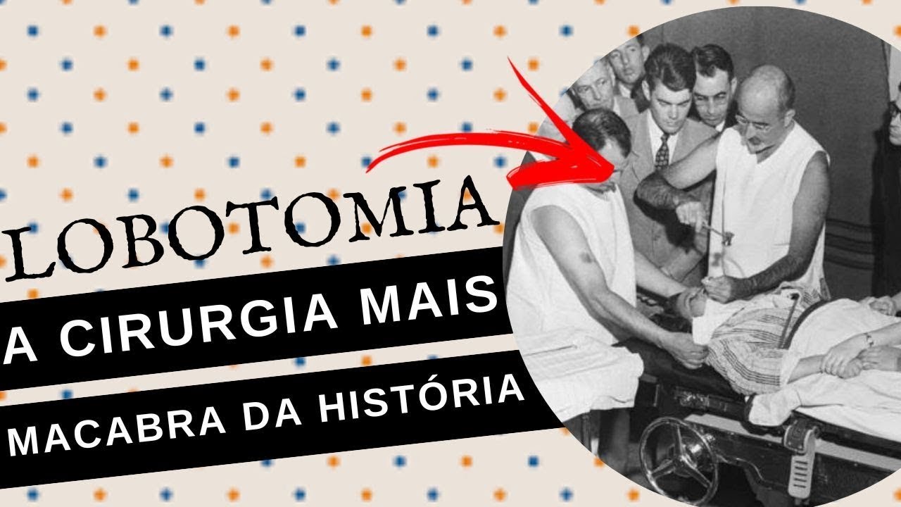 LOBOTOMIA: A BRUTAL CIRURGIA QUE ERA USADA PARA TRATAR DOENÇAS MENTAIS ...