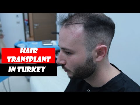 Hair Transplant in Turkey | Sercan Aslan Hair Clinic.