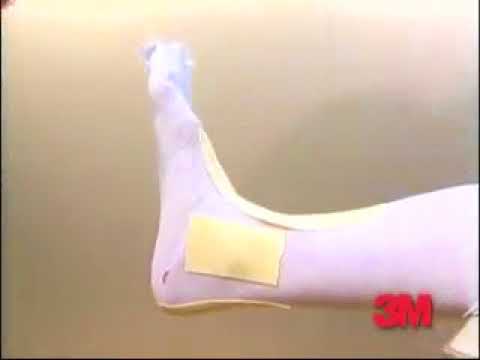 3M™ Scotchcast™ Soft Cast Casting Tape: Ankle Wrap Application and ...