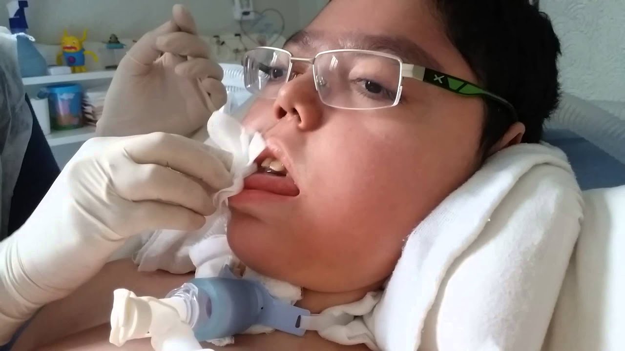 Fonoaudiologia de forma passiva. - YouTube