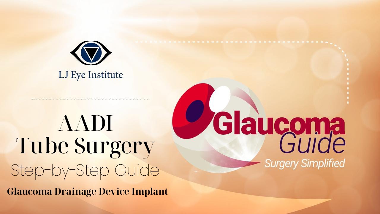 AADI Tube Surgery – Step-by-Step Guide | Glaucoma Drainage Implant ...