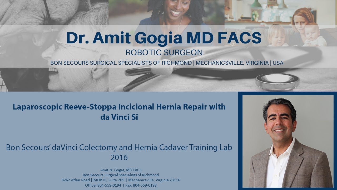 da Vinci Rives-stoppa Incisional Hernia Repair - YouTube