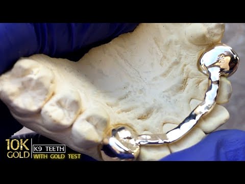 10K Solid Gold K9 Caps with Back Bar Hidden Bridge Canine Teeth (with ...