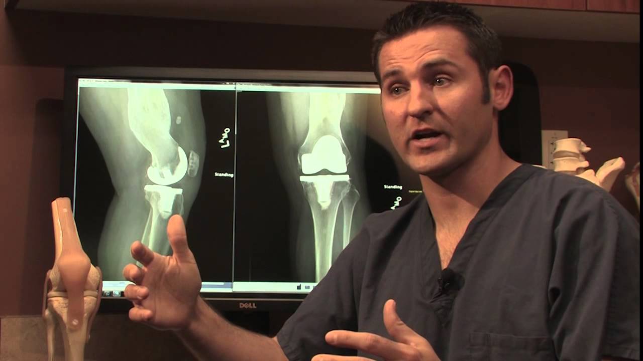 Knee Replacement Surgery - Dr Nathan Cafferky - YouTube