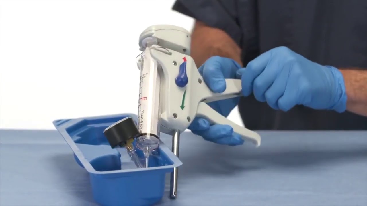 Set up and Use of the Alliance II Integrated Inflation Lithotripsy ...