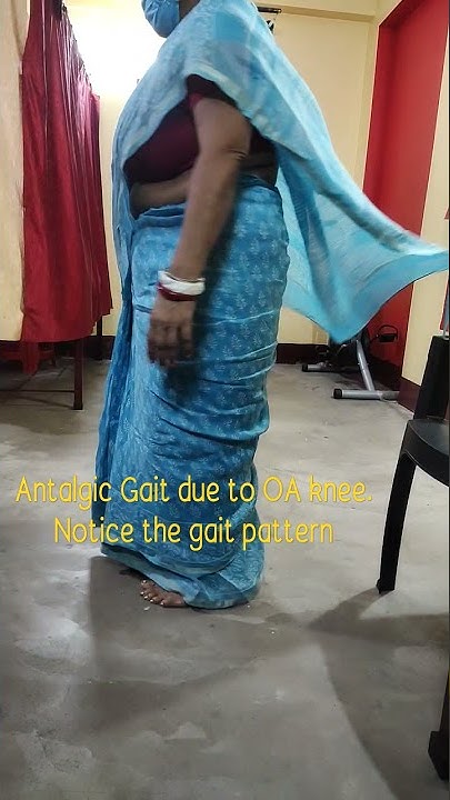 Antalgic Gait/Walking pattern due to pain/Pathological Gait ...