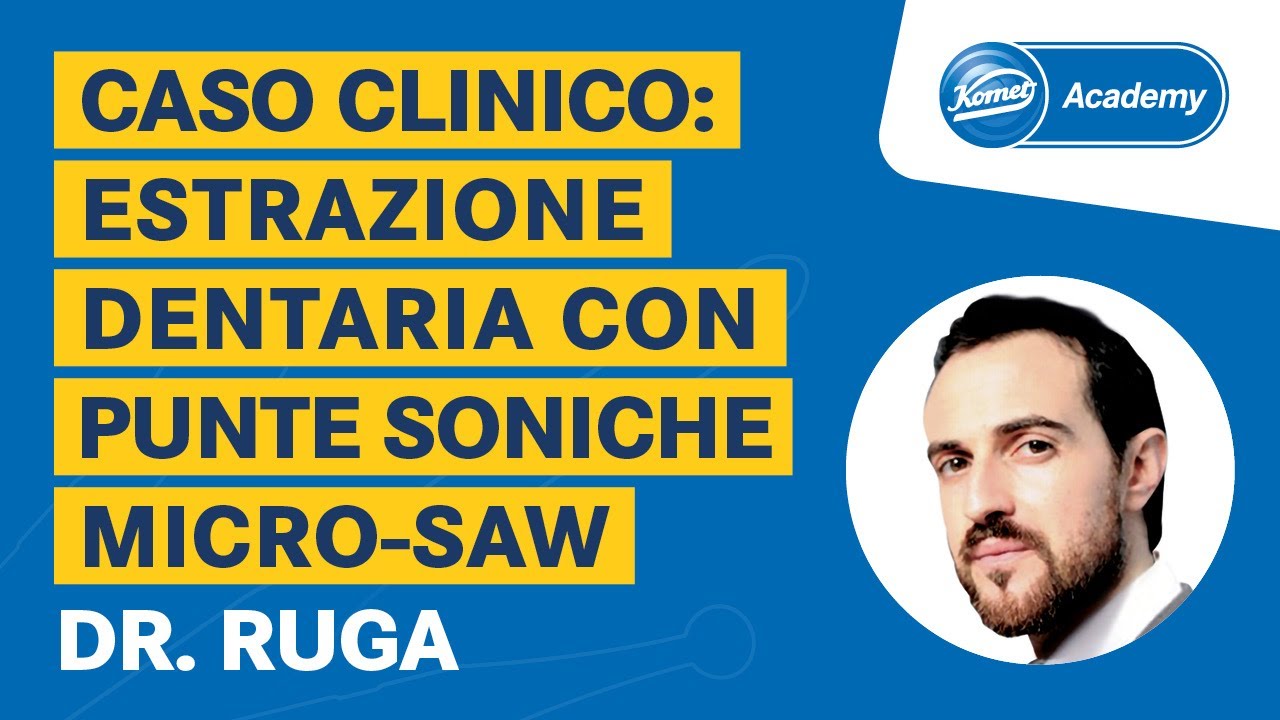 Caso clinico odontoiatrico di estrazione by Dr Ruga - YouTube