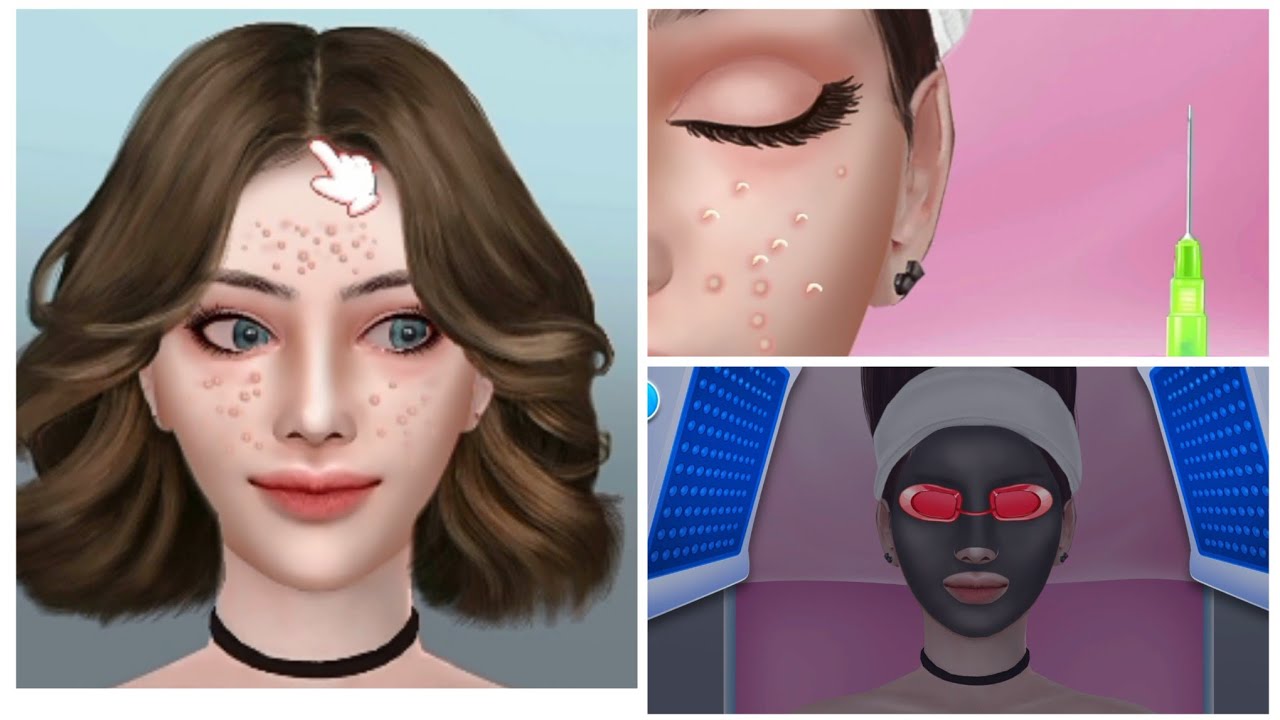 ASMR acne removal skin treatment||ASMR acne animation#Asmr#Fishii_ASMR ...