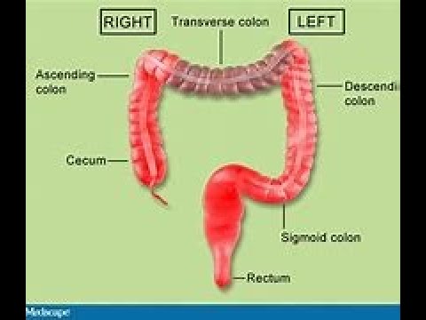 COLON CLEANSE AT HOME - YouTube