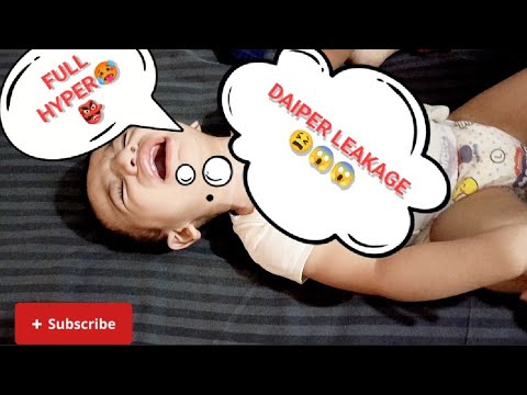 FULL OVER CONTROL CRYING DIAPER BABY DUE TO PAMPER CHANGINE SCENE| MR ...