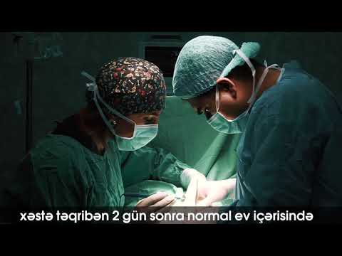 Mikroskopik Varikoselektomiya Əməliyyat Müddəti Nə Qədər Çəkir?