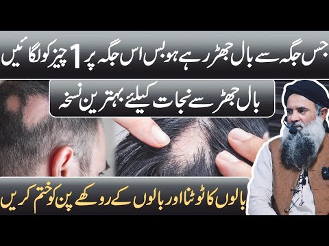Balchar Ka ilaj | Balchar Ka Desi ilaj | Balchar Ka Gharelu ilaj | Alopecia Ka ilaj Dr Sharafat Ali