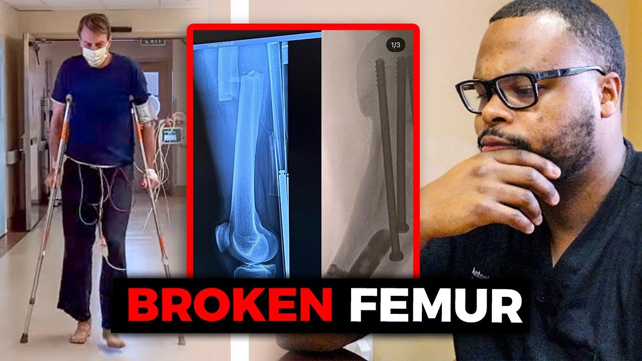 Orthopedic Surgeon Reacts to Tony Hawk's Femur Fracture - YouTube