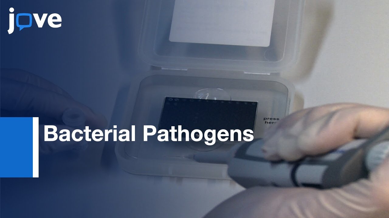 Gene Sequencing and MALDI-TOF MS to identify Bacterial Pathogens ...