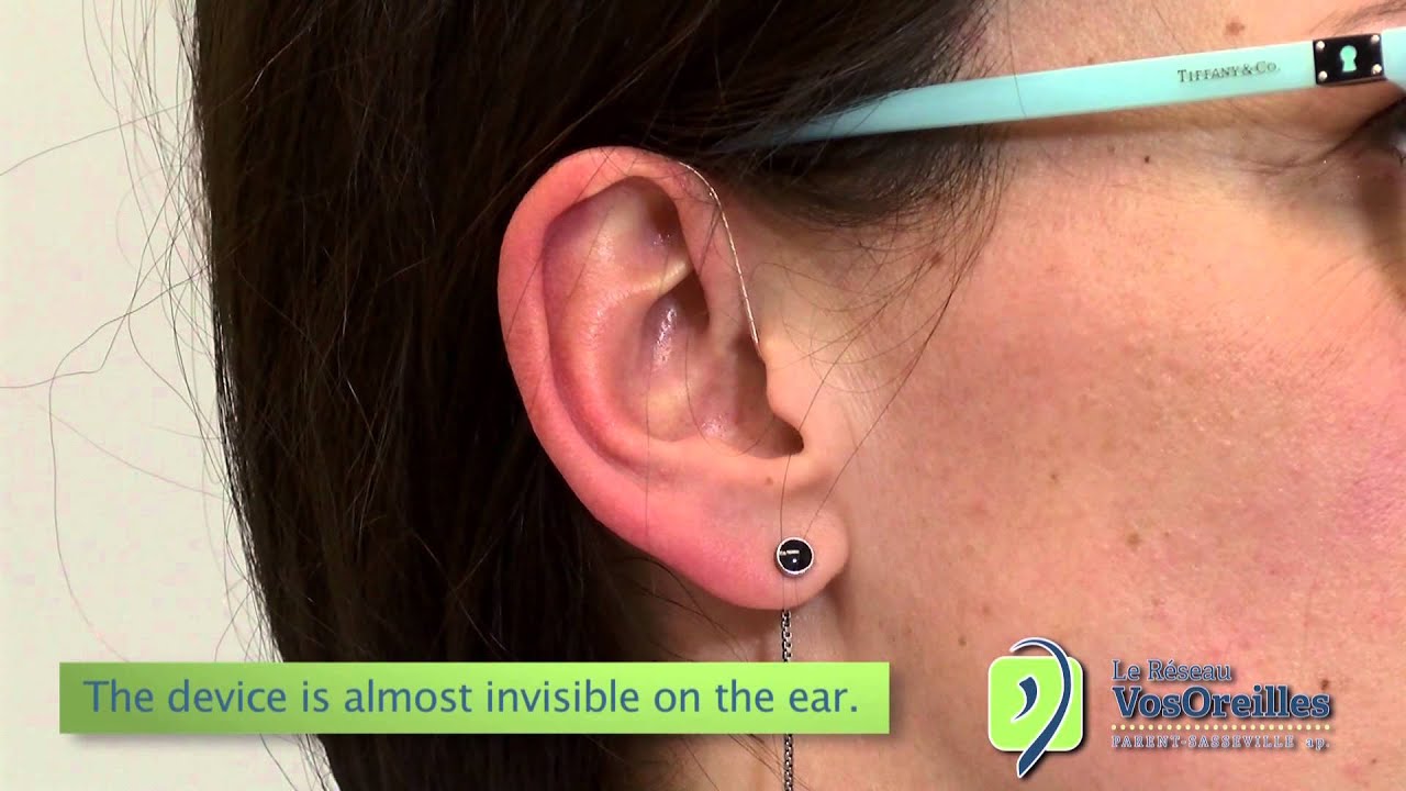 RIC - Installation and removal - YouTube