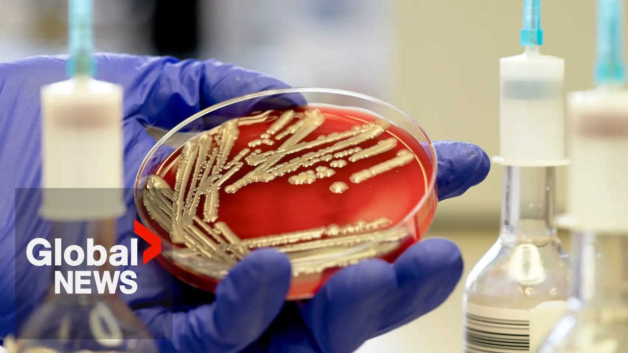 E. coli outbreak: How to protect yourself from bacteria, infection ...
