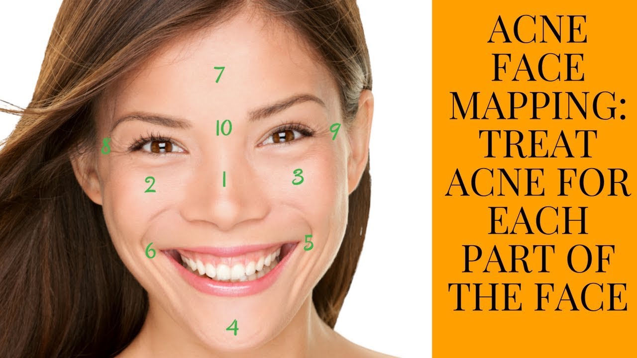 Acne 101:Chinese Style Acne Face Mapping for getting rid of acne ...