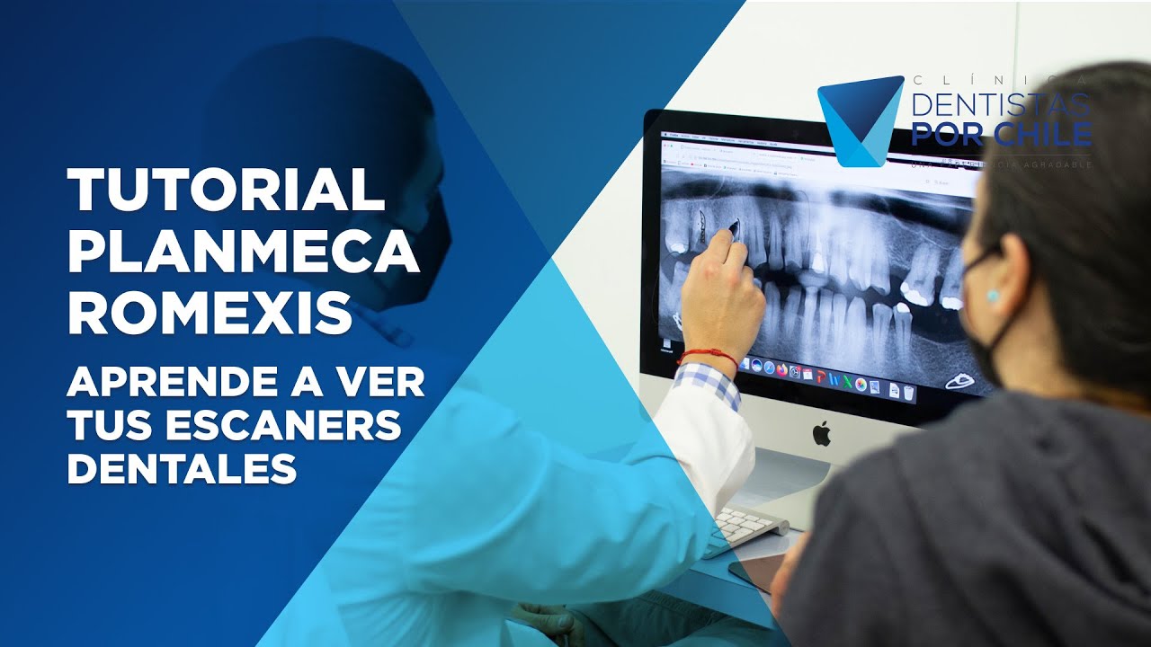 Tutorial Romexis Viewer para Windows y Mac - YouTube