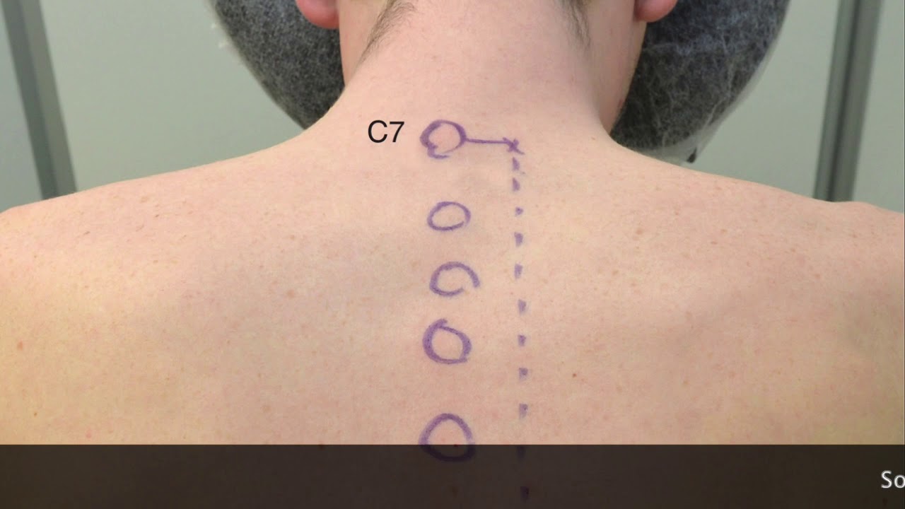 Thoracic Epidural Training EpiSIM 6 - YouTube