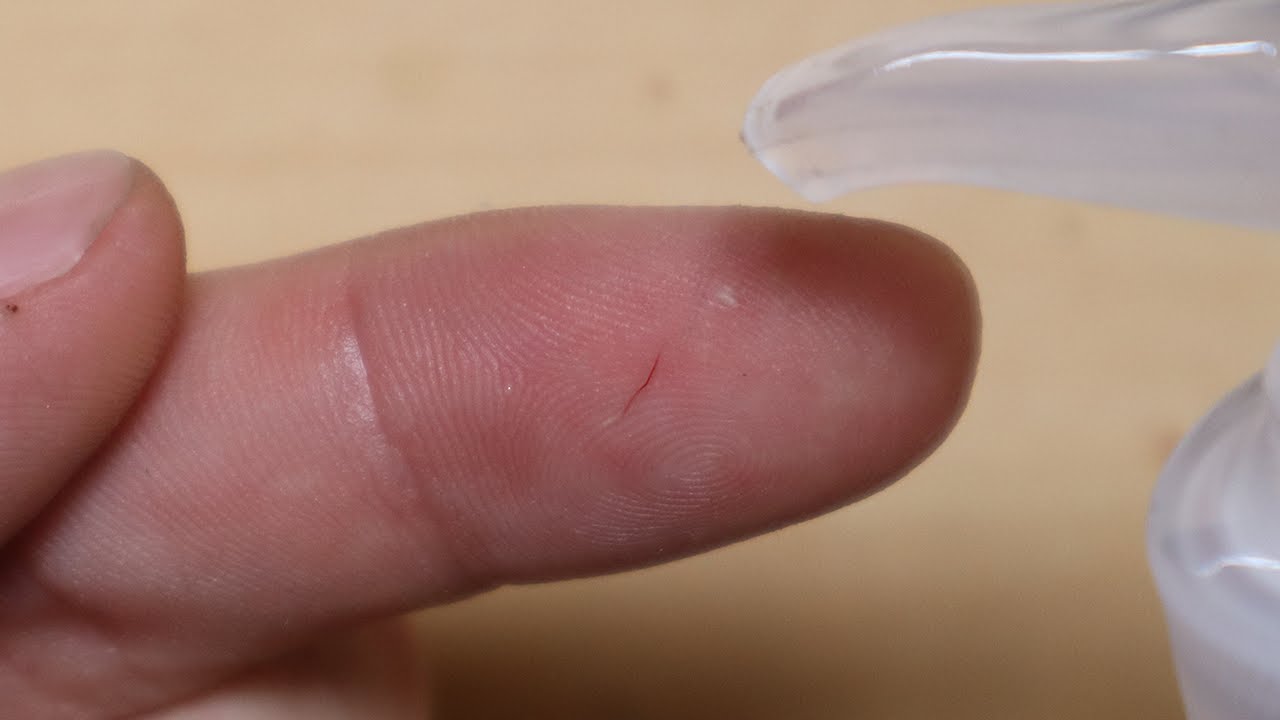 putting hand sanitizer in a papercut - YouTube