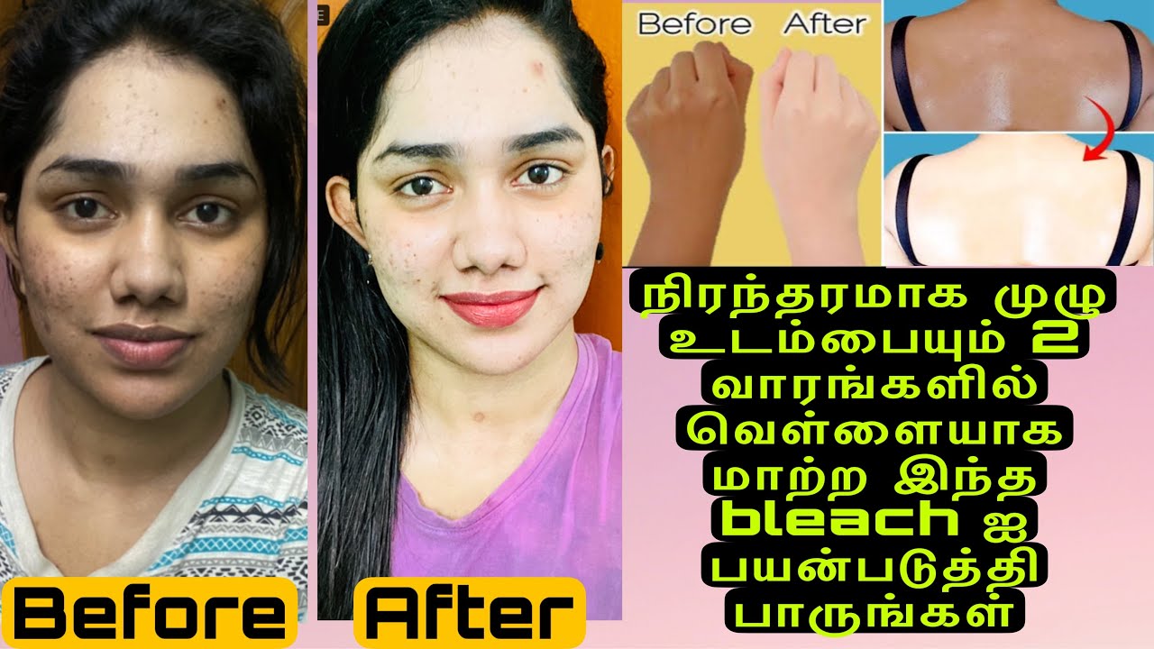 Permanent full body whitening bleach - see results in 2 weeks - YouTube